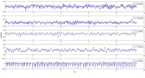 Figure 1 From Epilepsy Detection By Using Scalogram Based Convolutional