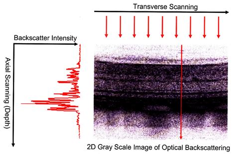 Figure 1 1 From Spectral Fourier Domain Doppler Optical Coherence Tomography In The Rodent