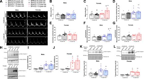 Hypertensive Bph2j Mice Exhibit Sex Specific Heart Failure Progression