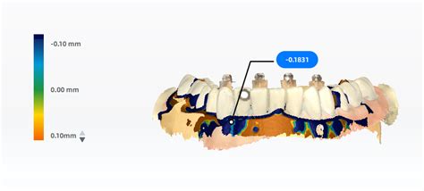 Interface Intraoralscan