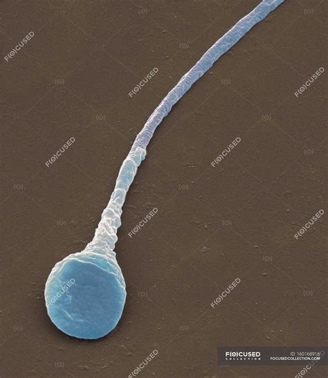 Human Sperm Cell Coloured Scanning Electron Micrograph Sem — Reproductive Cell Human