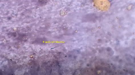 India Ink Preparation Introduction Principle Test Requirements Procedure Result