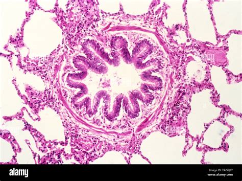 Light Micrograph Showing A Cross Section Of A Bronchiole And