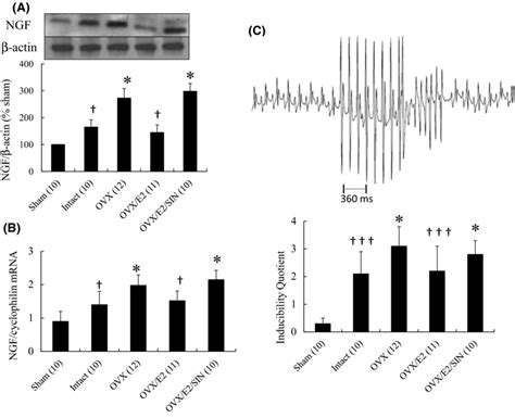 Ngf Protein And Mrna And Arrhythmias At 28 Day After Mi A Western Download Scientific Diagram