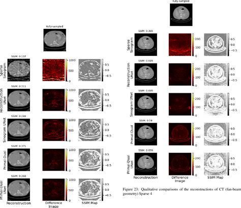 Figure 1 From Sinogram Upsampling Using Primal Dual Unet For Undersampled Ct And Radial Mri