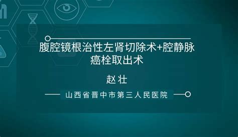 腹腔镜根治性左肾切除术 腔静脉癌栓取出术 赵壮