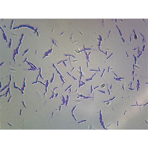 Prepared Microscope Slides Bacteria At Ami Hernandez Blog