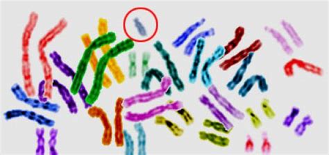 Sex Influenced Traits Sex Limited Traits And Medical Examination