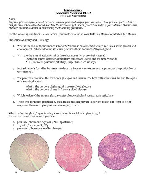 Lab 1 Endocrine Lab LABORATORY 1 ENDOCRINE SYSTEM ELISA IN LAB 1 ASSIGNMENT Name Anytime