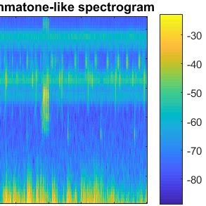 Spectrogram Comparison Using Three Time Frequency Representations