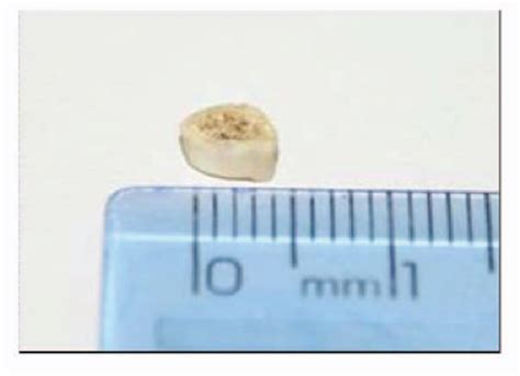 Figure 1 From Mapping Lead Distribution In Bones By Dual Energy Computed Microtomography With