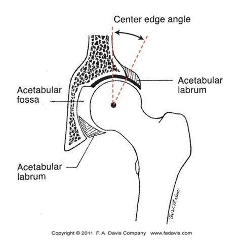 Exam2 Hip Angles Normal And Abnormal Values Flashcards Quizlet