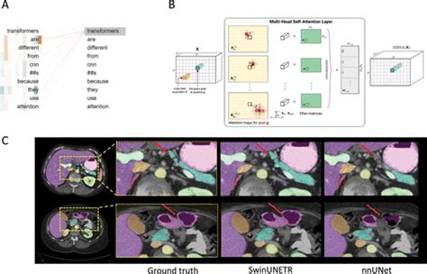 toward foundational deep learning models for medical imaging in the new era of transformer