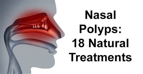 What Nasal Polyps Look Like