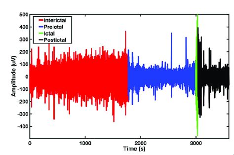 An Eeg Signal And Its Different States The Sampling Frequency Is 256