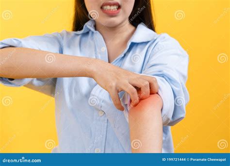 Close Up Allergy Rash Around Back View Of Human With Dermatitis Problem Of Rash Allergy Rash