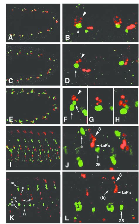 Comparison Of Slou S59 And Ladybird Expression In Normal Muscle