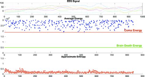 Results For Coma Patient EEG Data Download Scientific Diagram