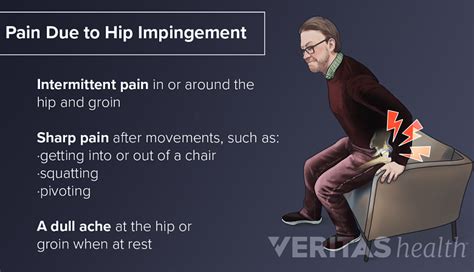 Hip Pain That Travels Down The Leg Arthritis Health