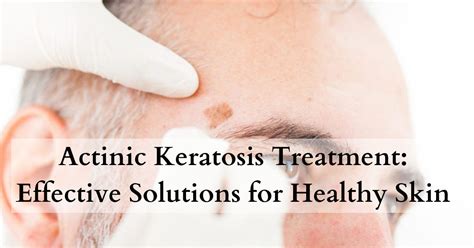 Actinic Keratosis The Common Precancer You Should Know 52 Off
