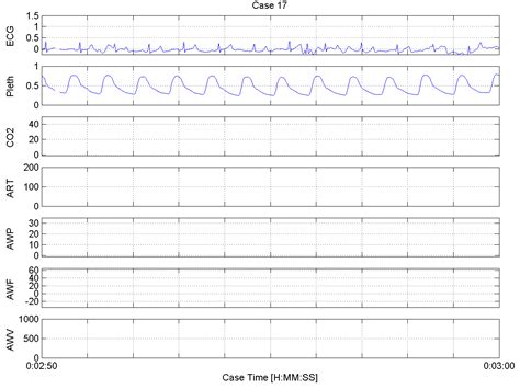 Case 17 Waveform Plots 10 Second Plots