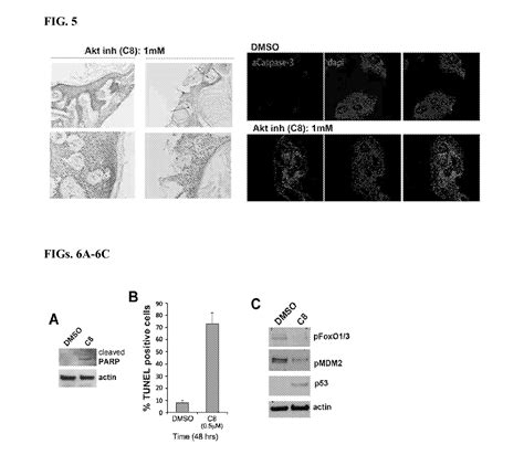 Seborrheic Keratosis Patented Technology Retrieval Search Results