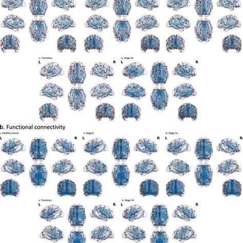 Binarized Connectivity Matrices From Each Stage Of Smi Risk Depicted On Download Scientific