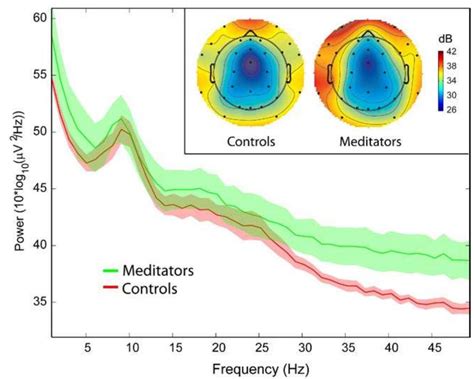 Inset Scalp Maps Showing Spectral Power Scale In Db For