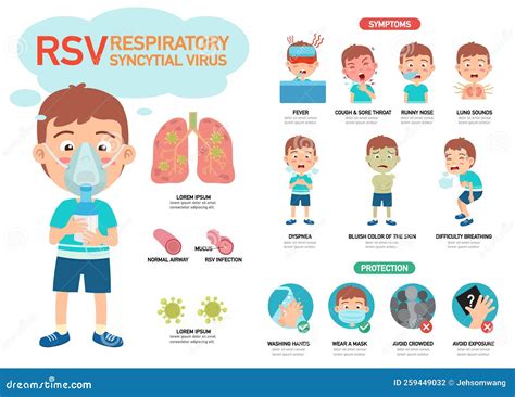 Rsv Respiratory Syncytial Virus Infographic Stock Vector Illustration