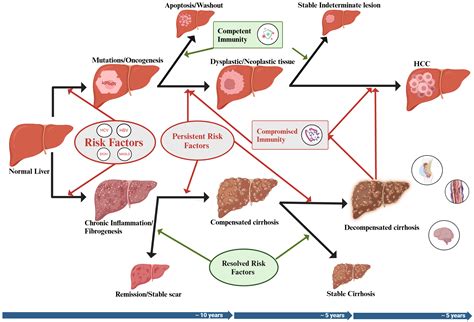 Pathophysiology Of Liver Cirrhosis And Risk Correlation Between Immune Status And The