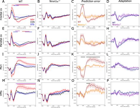 Auditory Event Related Potentials And Mismatch Responses A E I M Download Scientific Diagram