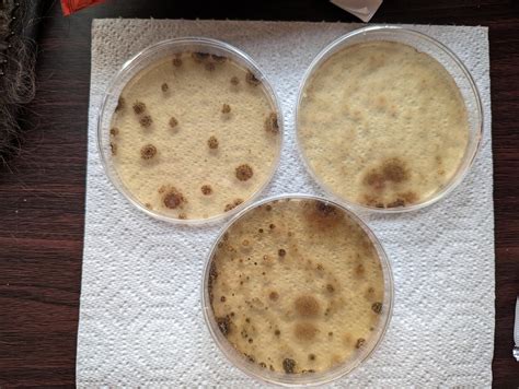 Help [identification] R Microbiology