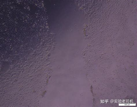 手把手教学——划痕实验（细胞迁移）的实验流程及经验分享 知乎