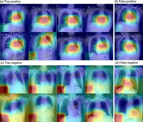 Representative Gradient Weighted Class Activation Mapping Results Download Scientific Diagram