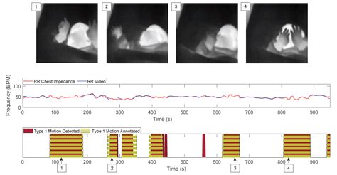 Towards Continuous Camera Based Respiration Monitoring In Infants