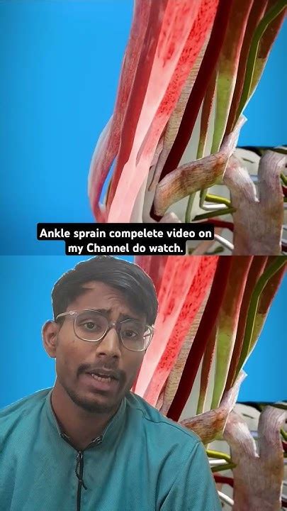 How Ankle Sprain Occurs Ankle Twisting Injury Youtube