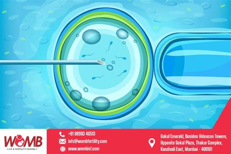 What Is Ivf Treatment Womb Ivf Fertility Center Mumbai