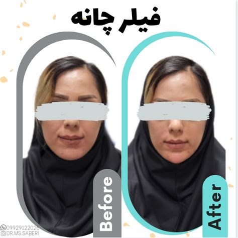 ‎دکتر محمد سعید صابری متخصص پوست مو زیبایی‎ Drmssaberi