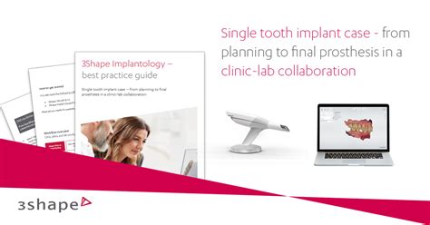 3shape New Step By Step Guide For Single Tooth Implant