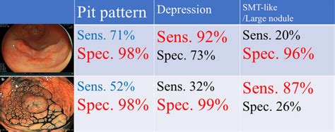 Pit Pattern Observation Shows A Higher Diagnostic Accuracy Compared To