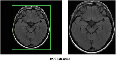 Roi Extraction For One Mri Sample Download Scientific Diagram