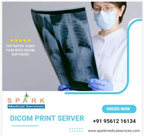 Spark Dicom Xray Printing Software Free Demo Available At ₹ 5000piece