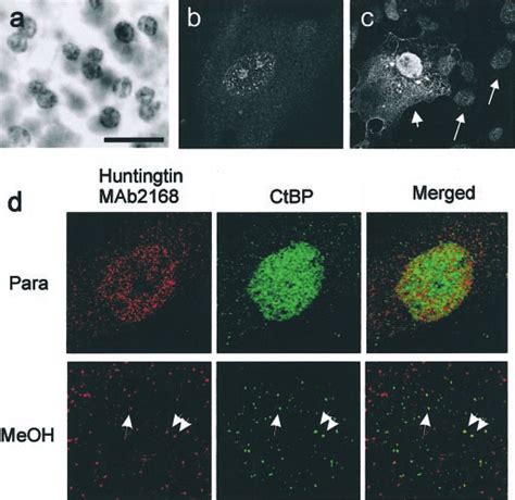 A Immunohistochemistry With Anti Ctbp1 In Mouse Brain Cortex Shows Download Scientific Diagram