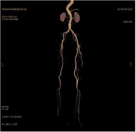 Multi Slice Computed Tomography Scan Msct With Three Dimensional Download Scientific Diagram