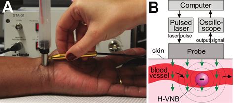 A Experimental Laboratory Prototype Of A Malaria Diagnostic Device