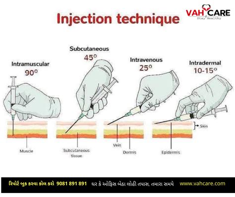 Simple Guidance For You In How Many Types Of Injections Are There