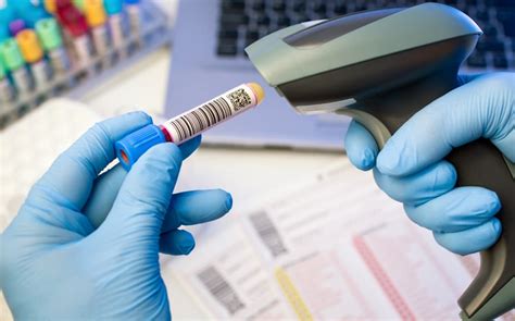 Advantages Of A Barcode Based Sample Management System