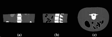 Figure 6 From A Bpf Fbp Tandem Algorithm For Image Reconstruction In Reverse Helical Cone Beam
