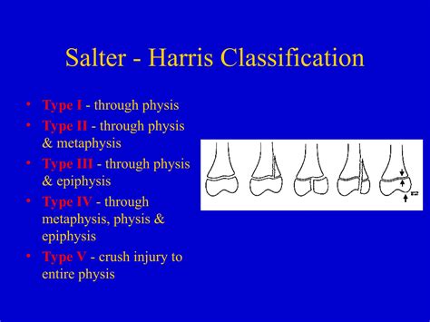 Fracture Classification And General Principles Of Management Ppt