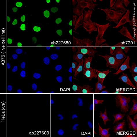 Anti Sox10 Antibody Sp267 Rabbit Monoclonal Ab227680 Abcam